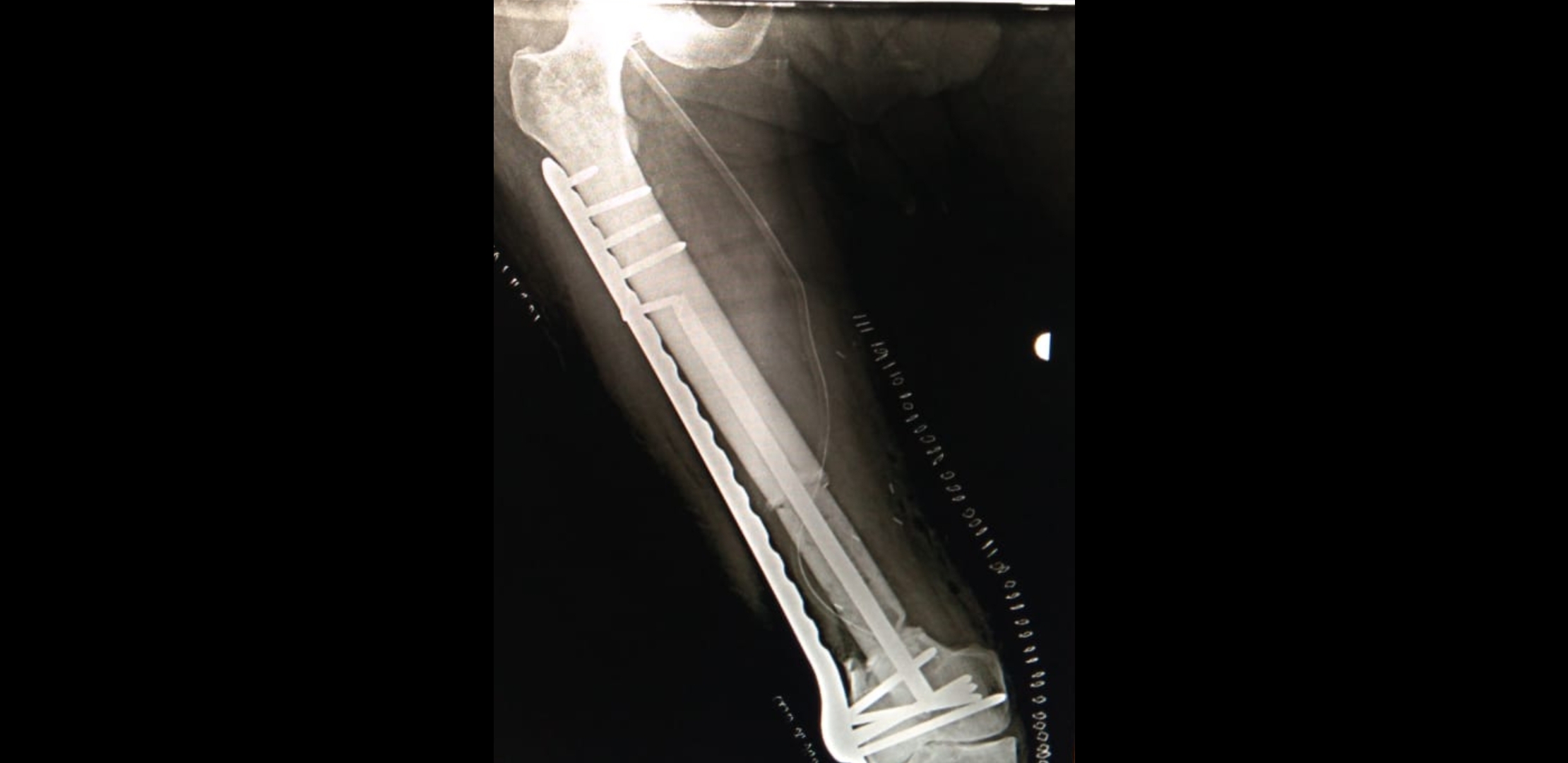 Gallery | Joint and Bone Solutions